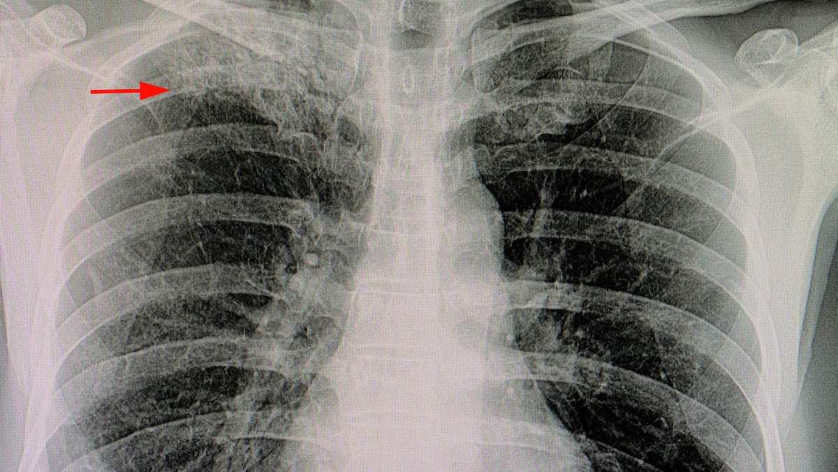 L'Ukraine et la RDC en alerte: «Ca commence à faire peur»: la lutte ...