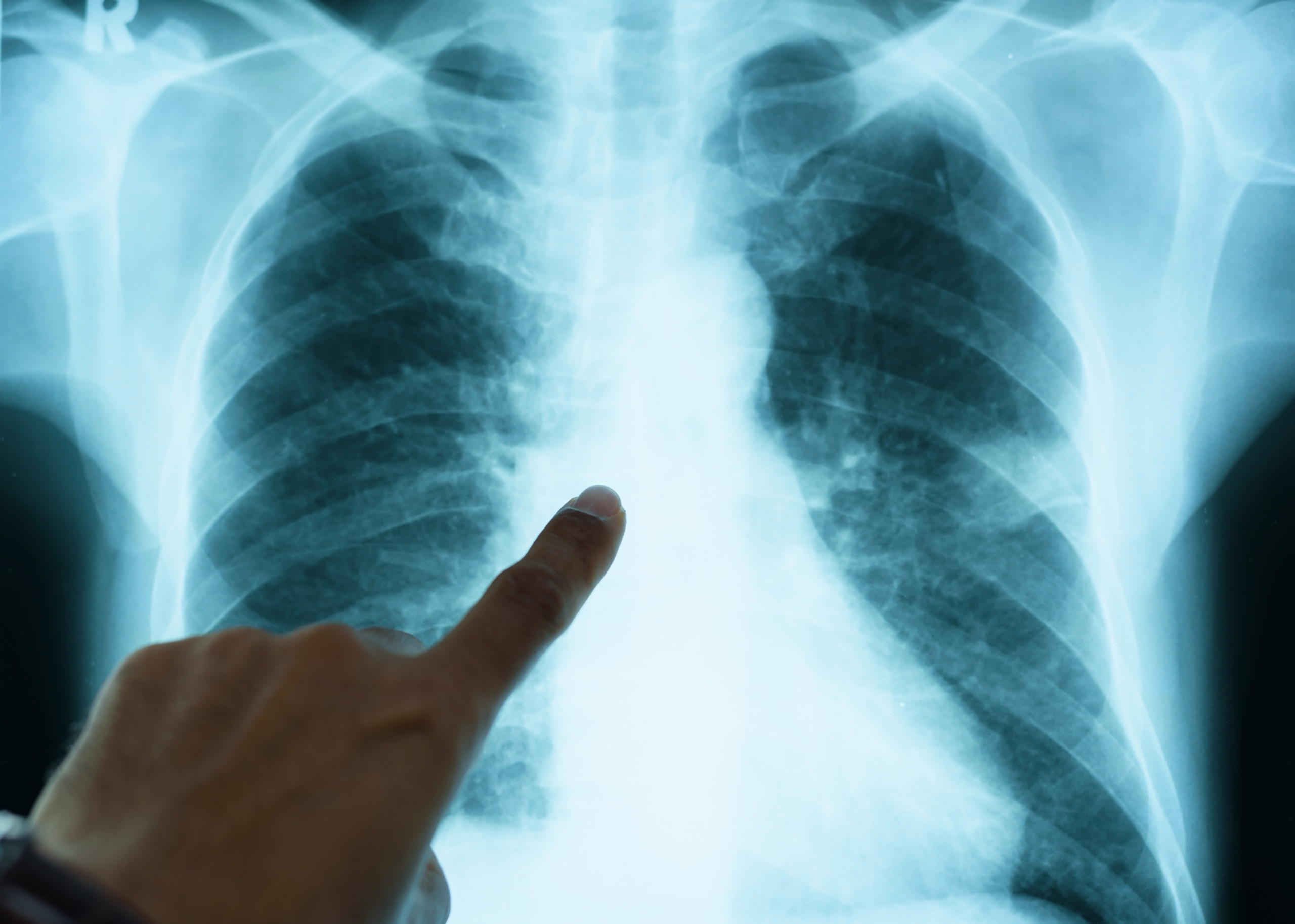 20 High-Impact Painting Techniques for a Bold Home Refresh