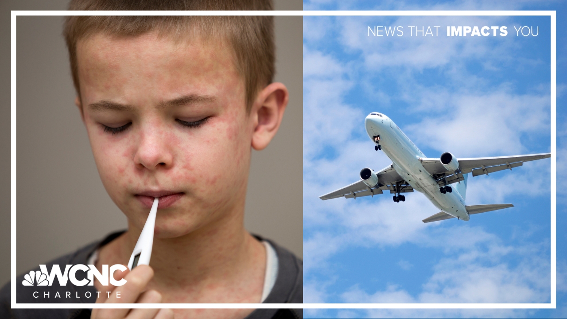 CDC issues measles warning for travelers