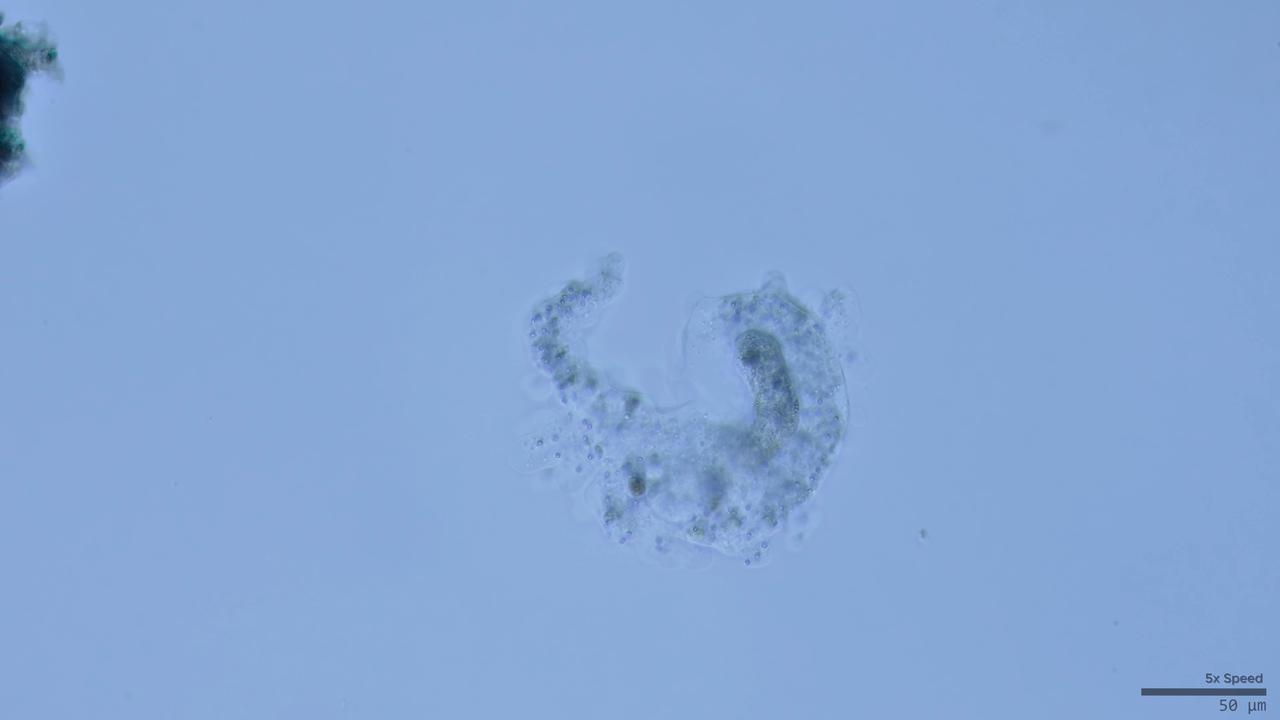 Amoeba Consuming a Single Celled Organism