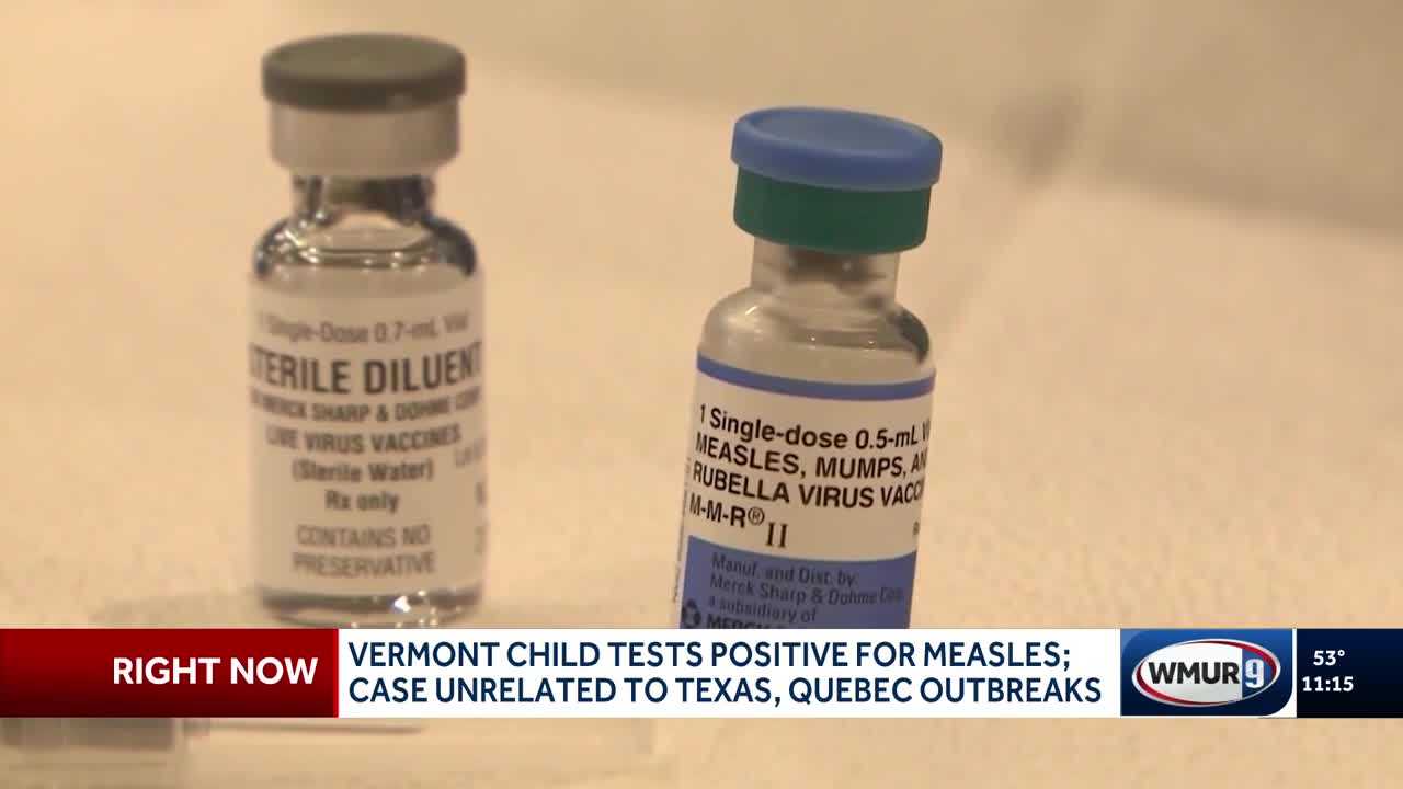 Vermont child tests positive for measles, first case in 2025, officials ...