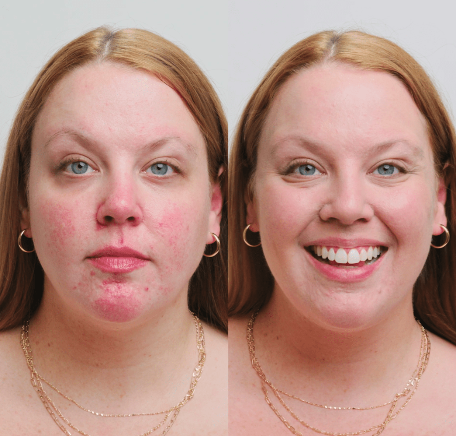 A viral eye cream, a hair treatment that works in 8 seconds and more ...