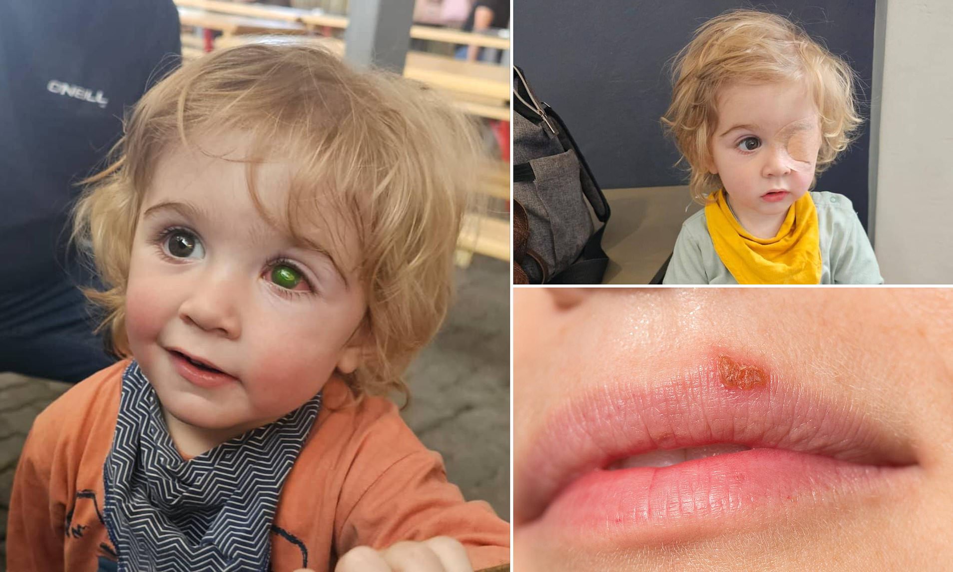 Toddler faces losing an eye after loved-one makes little-known mistake