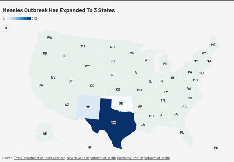 Map Shows Measles Outbreak Has Expanded To 3 States