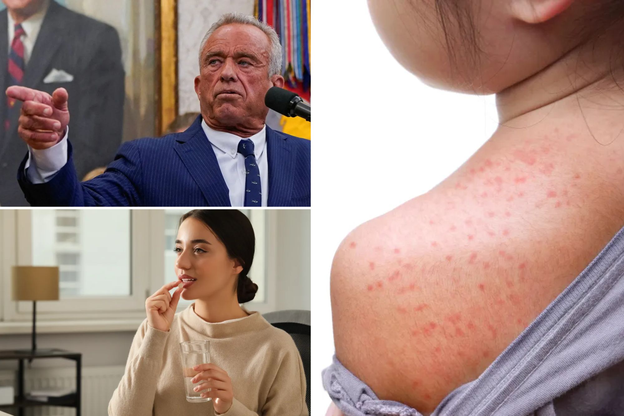 Should you be taking a vitamin A supplement? All the thing the nutrient ...