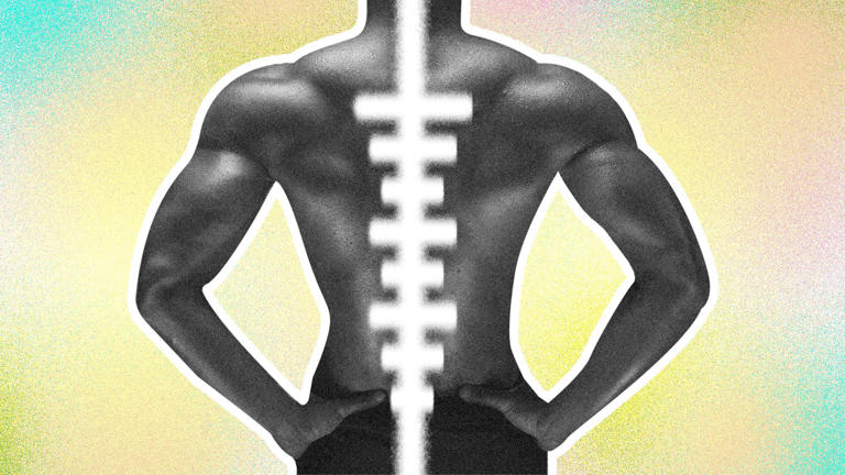 Anterior Pelvic Tilt, Explained: How the Angle of Your Hips Can Throw ...