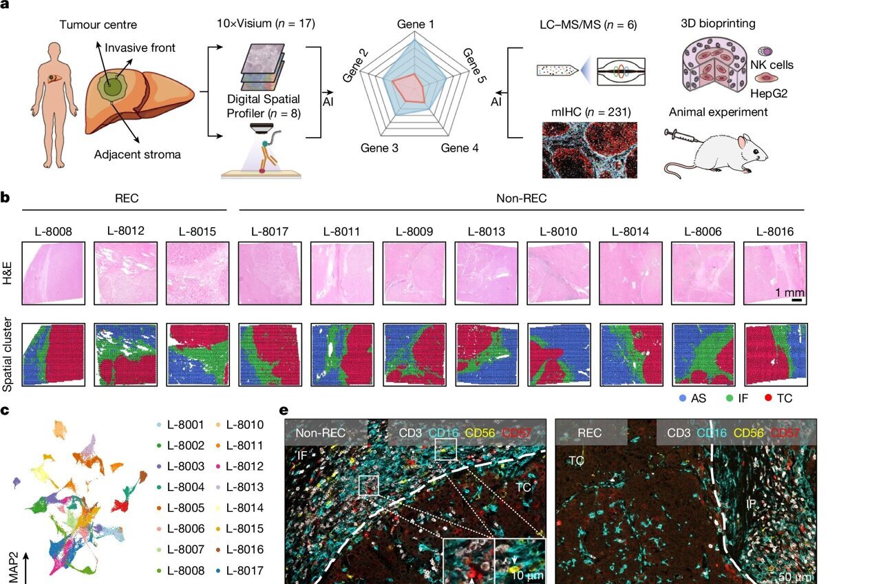 Novel spatial immune-based risk prediction platform can predict ...