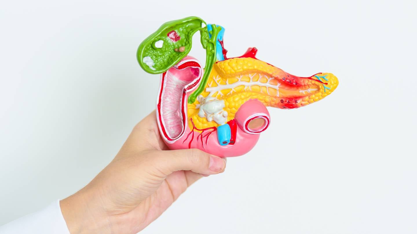 OSE announces overall survival success in Phase II PDAC vaccine trial