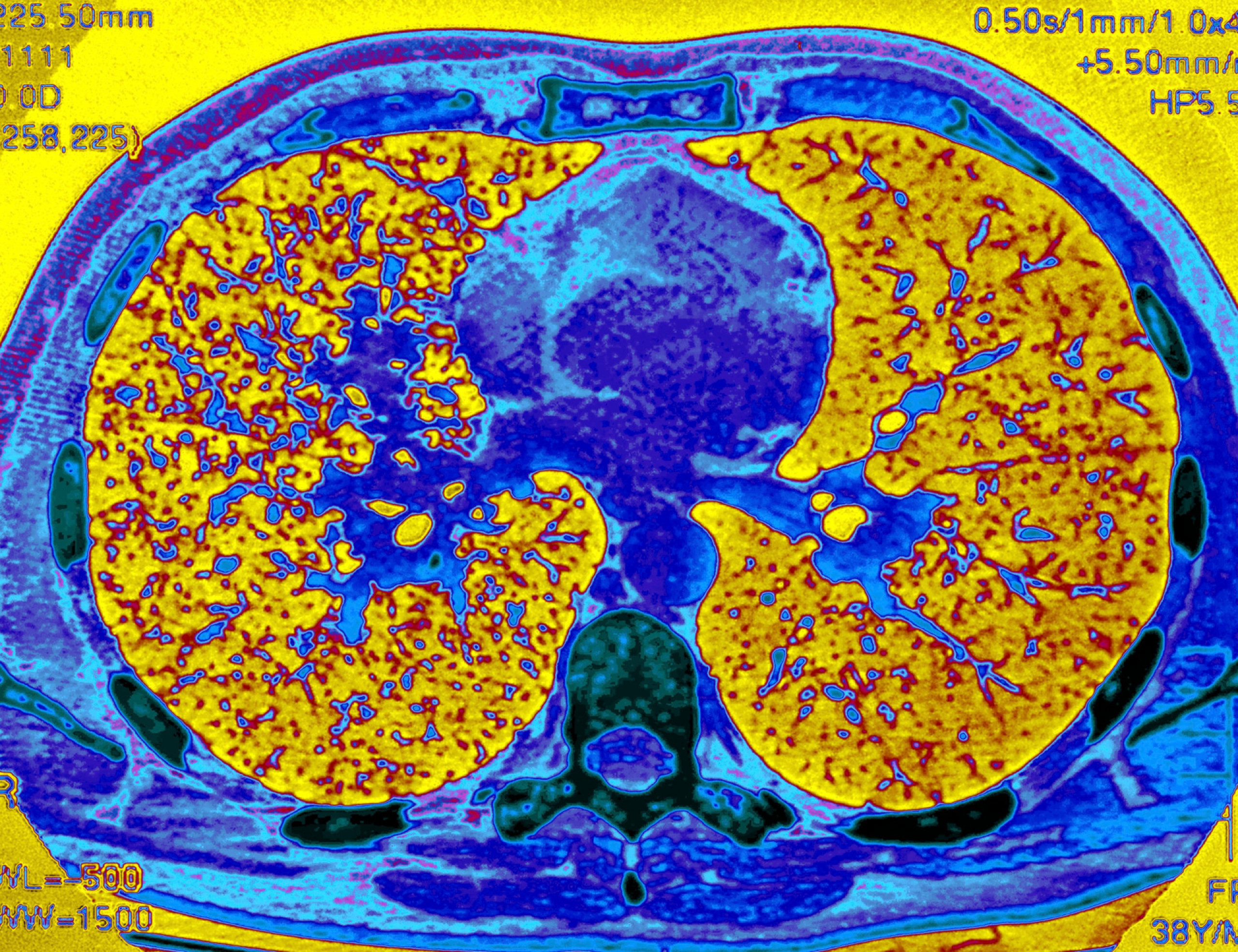 12 Almost-Extinct Fast-Food Chains Are Still Serving Customers Somewhere