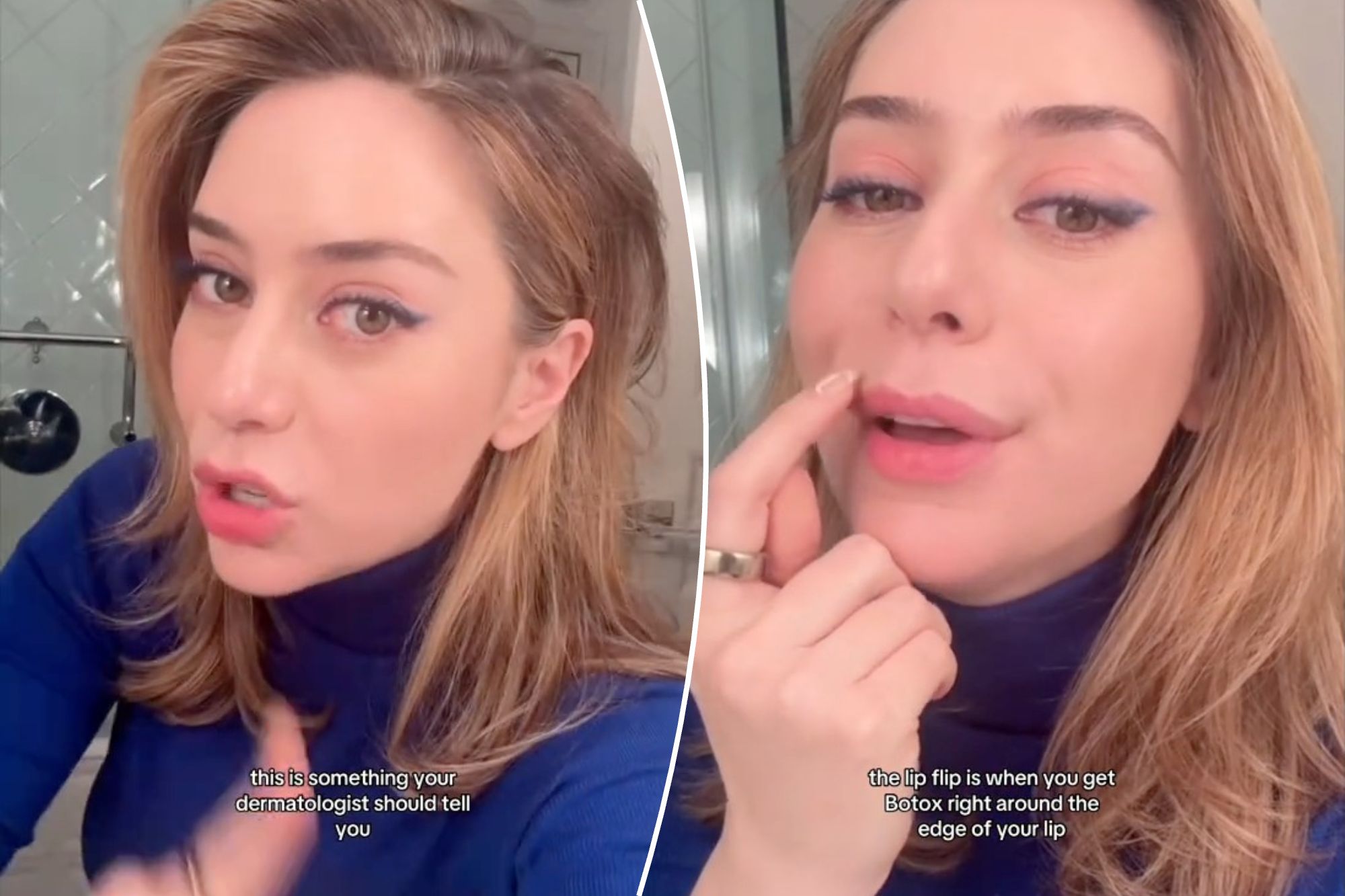 Doctor warns about little-known side effects of this popular Botox ...