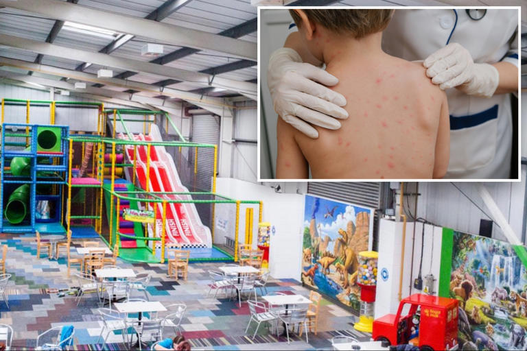 ‘Selfish’ parents ripped for hosting chickenpox party at indoor ...