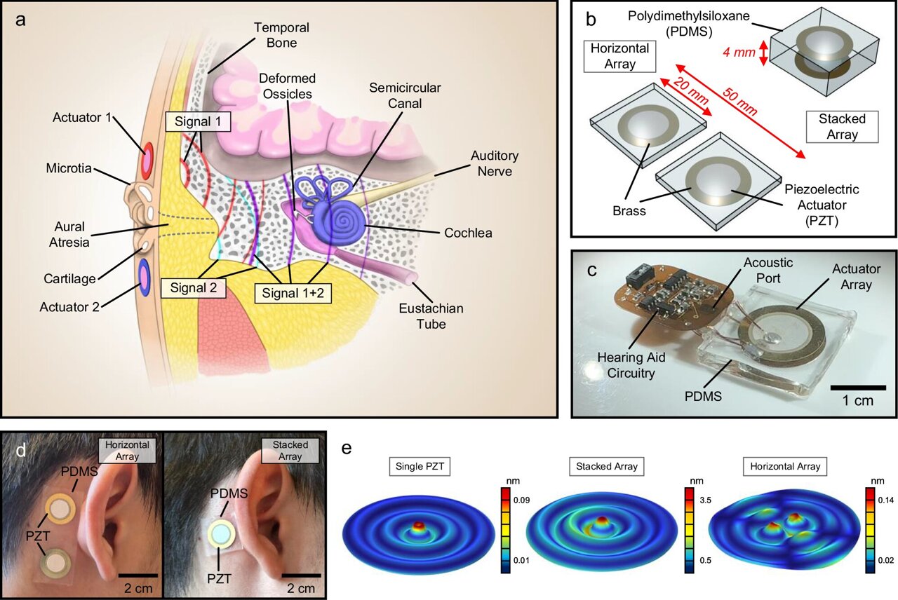 New non-invasive hearing aid may serve as alternative to implanted ...