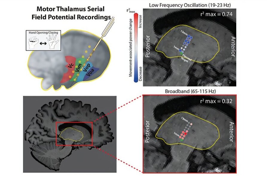 Thinking outside the box: Uncovering a novel approach to brainwave ...