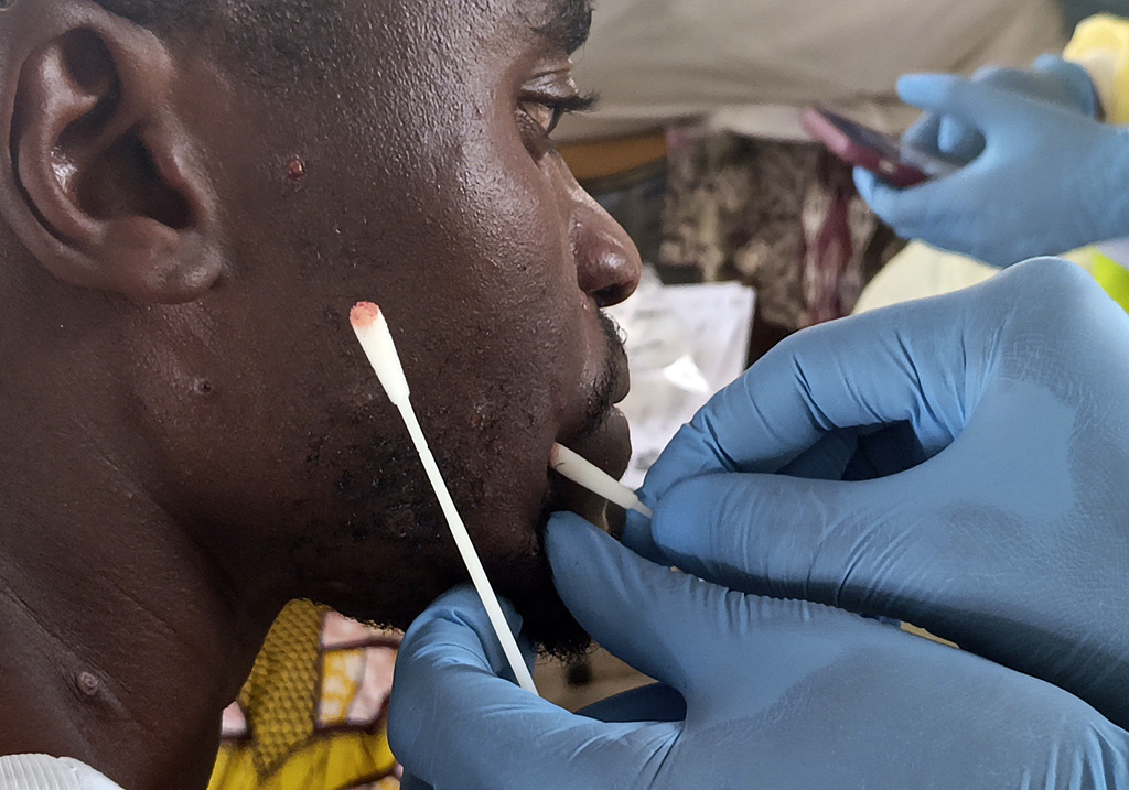 US aid cuts are hurting Africa's ability to respond to disease ...