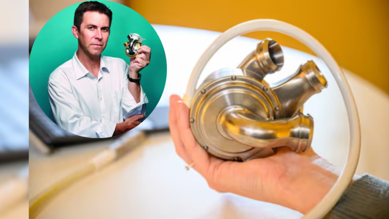 In 'First-Of-A-Kind' Surgery Man Lives For 100 Days With Artificial ...