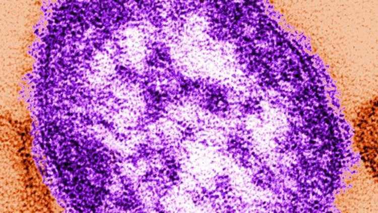 Concern for measles outbreak in Iowa elevated by state's lower overall ...