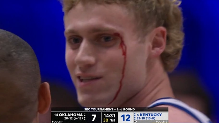 Kentucky's Collin Chandler Sustained Gruesome Cut Near Eye vs. Oklahoma
