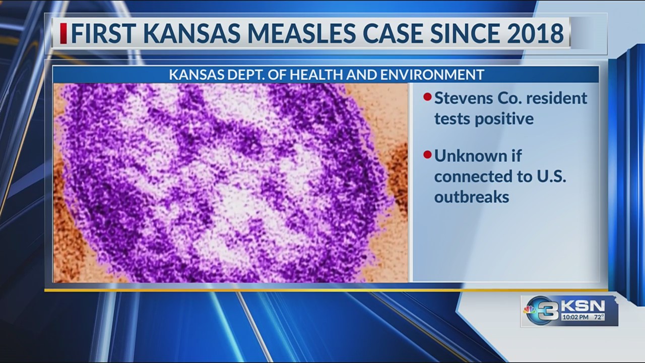 Kansas reports first Measles case