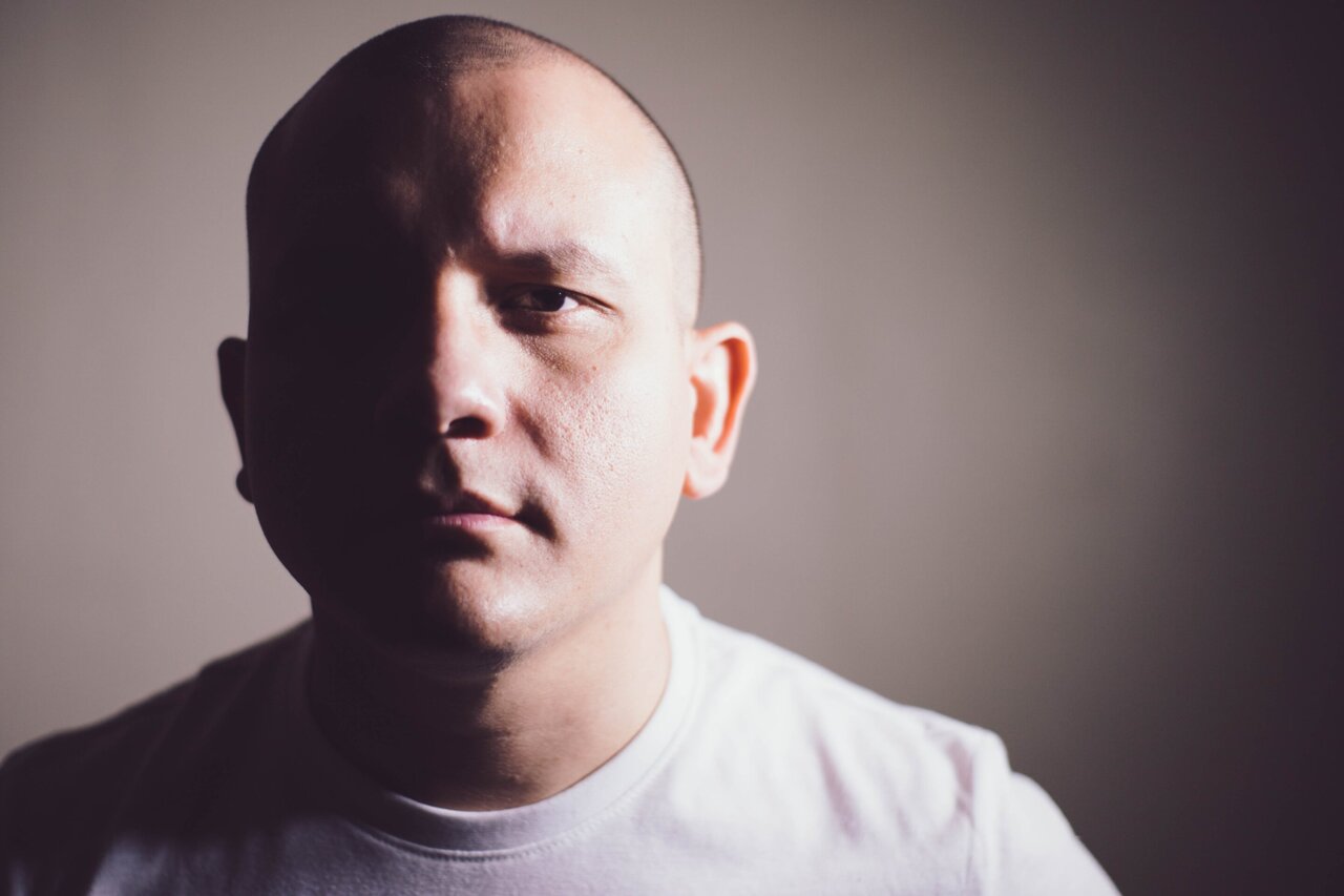 Did UCLA just cure baldness? How geneticists are reawakening ...