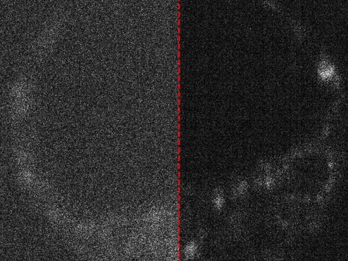 New Camera Technology Revolutionizes Biological Imaging of Live Cells