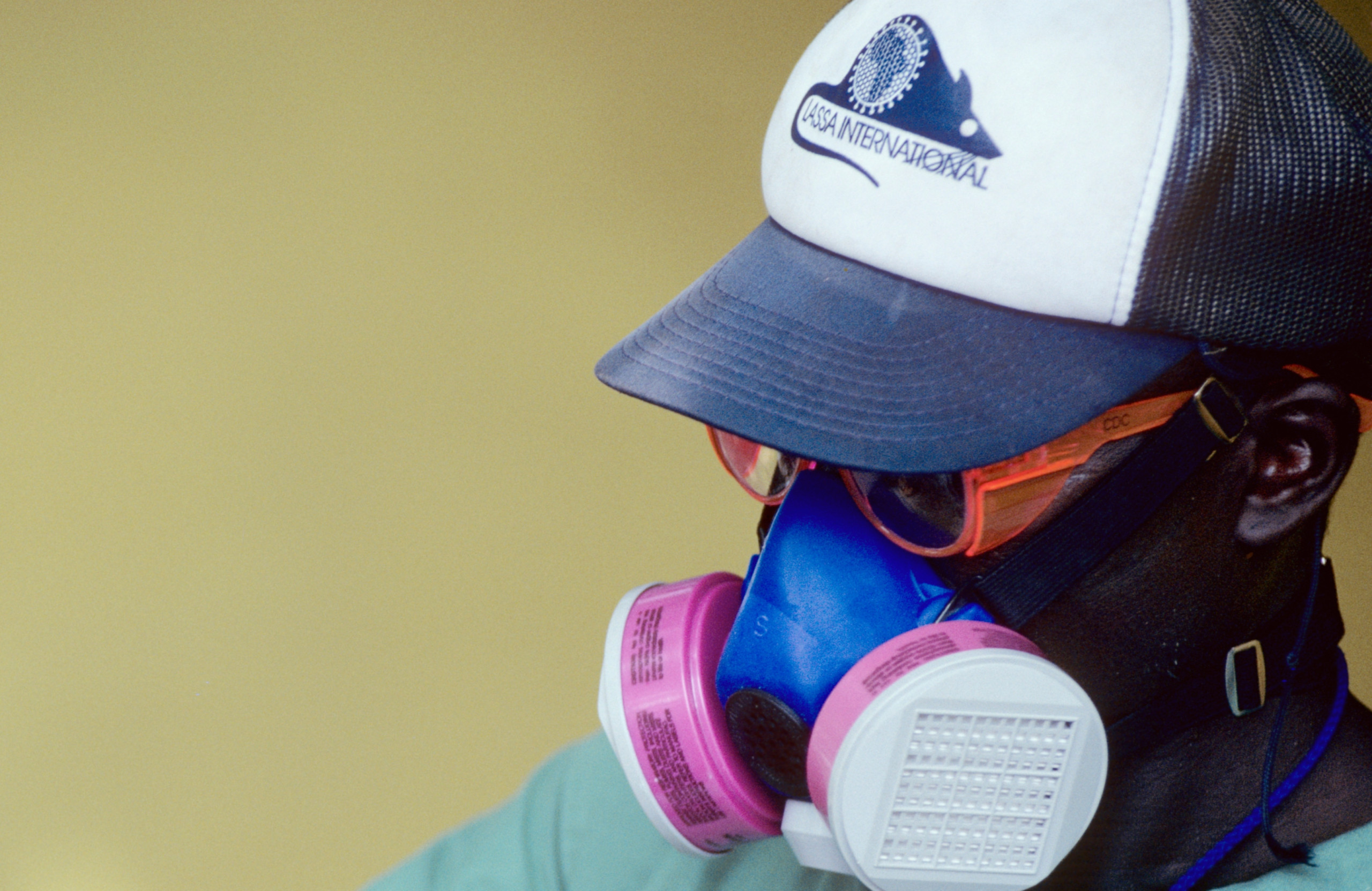 What you need to know about Lassa fever