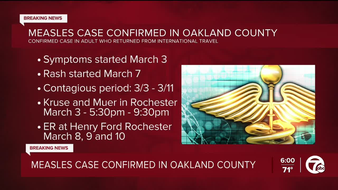 Oakland County Health Department confirms measles case in adult