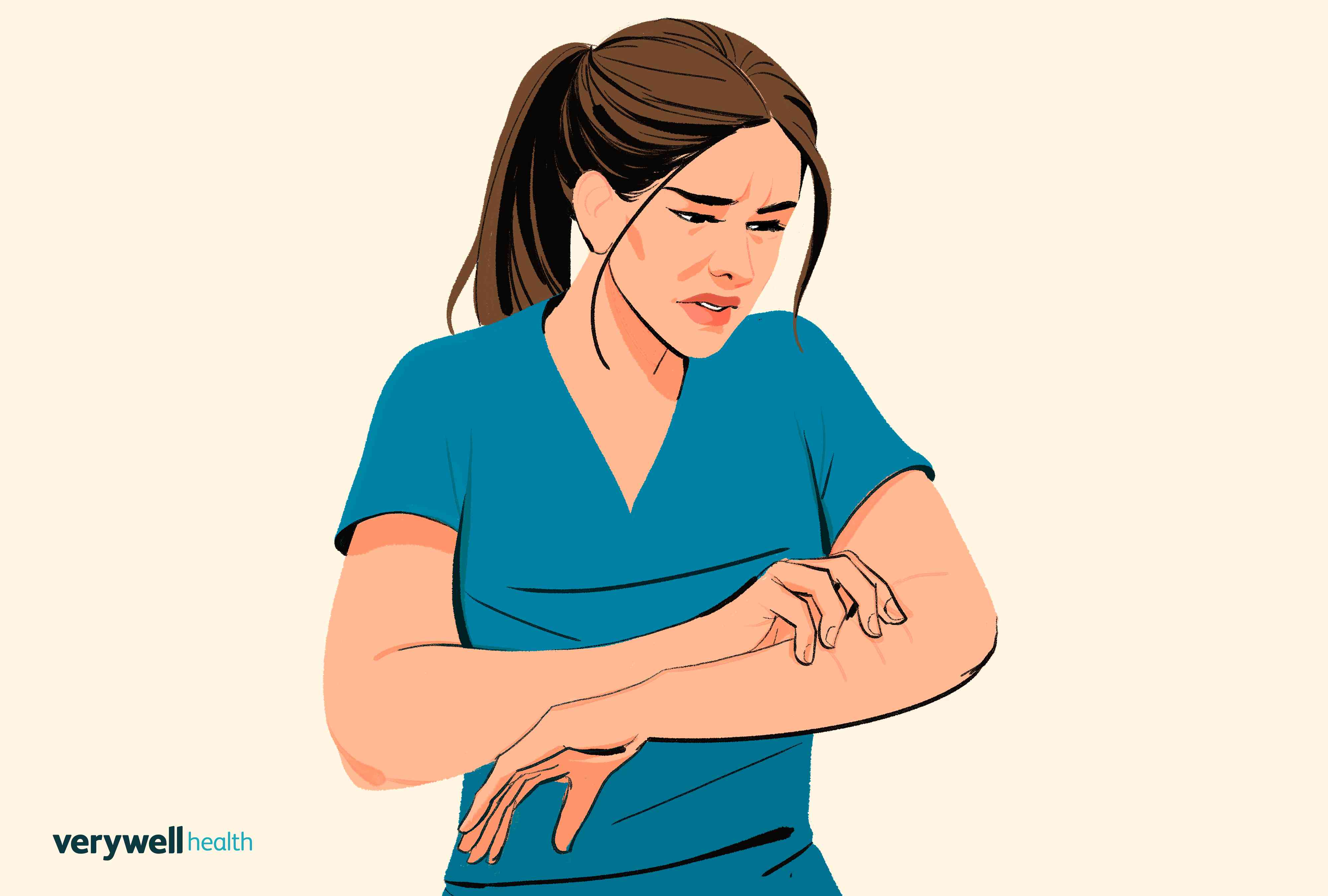 Do You Get Rashes With Your Period? It Could be Progestogen ...