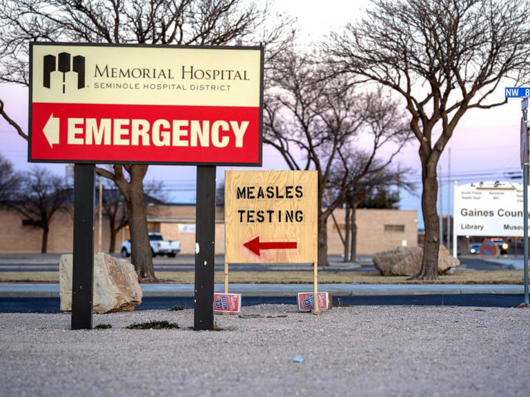 Measles cases reach 1,046 in US as infections confirmed in 30 states: CDC