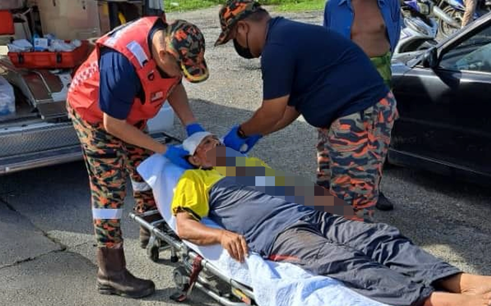 Man survives freak accident after metal rod impales jaw