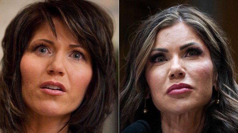 Kristi Noem Is Unrecognizable In Old Photos (& Looks Better Without The ...