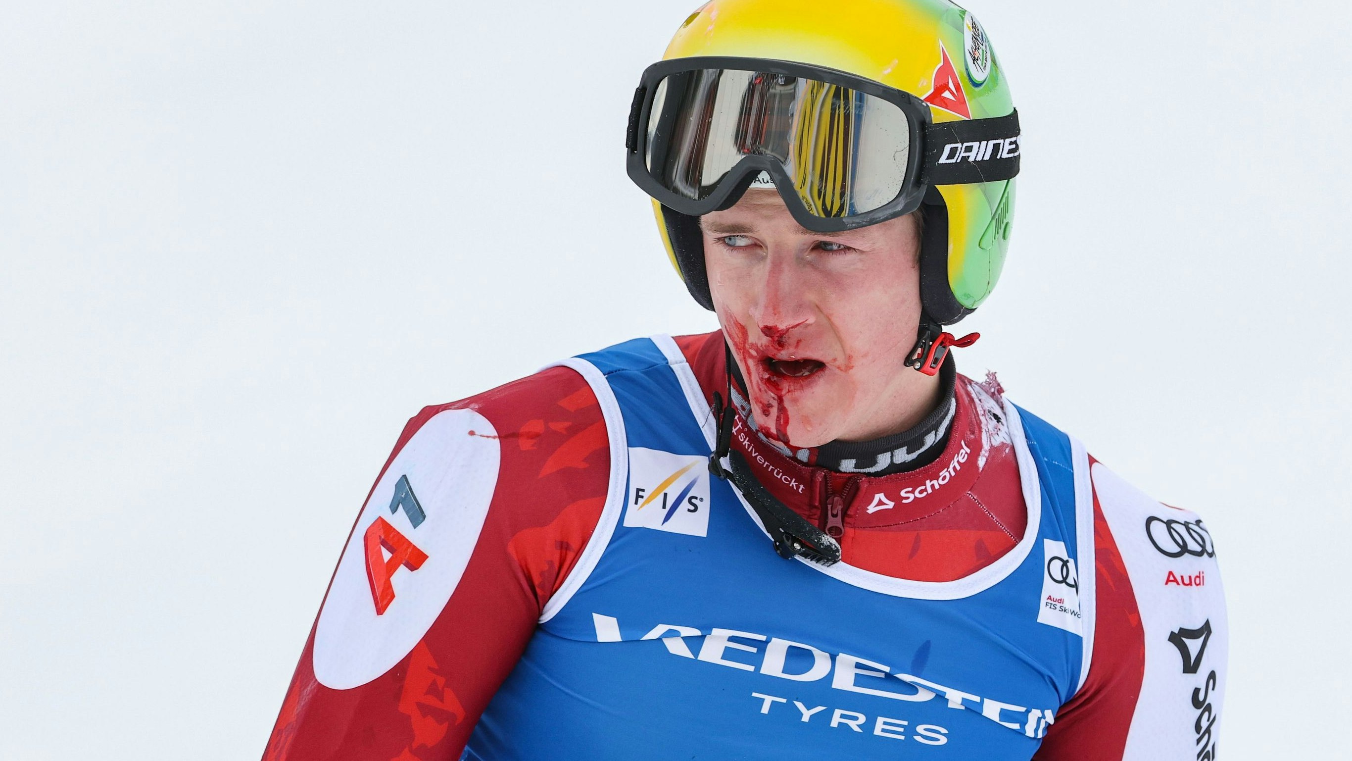 Haaser nach Blut-Crash: "Schmerzen sind entsetzlich"