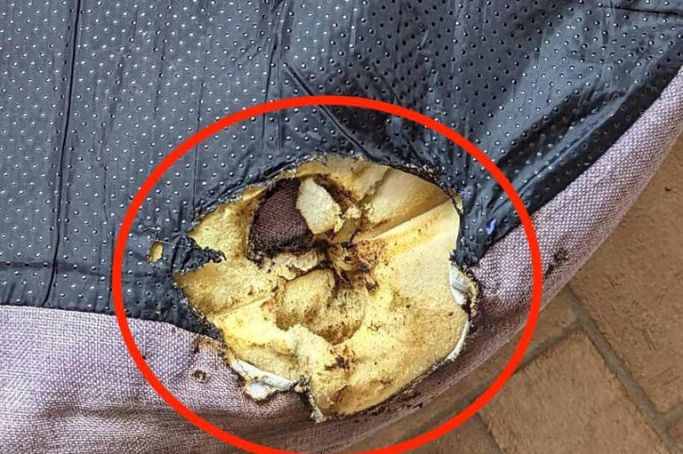 Woman needs skin graft after vape battery in pocket sets her leg on fire