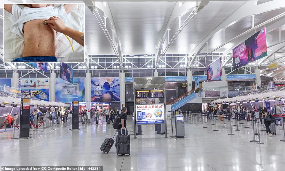 Health officials warn about potential measles outbreak at JFK airport