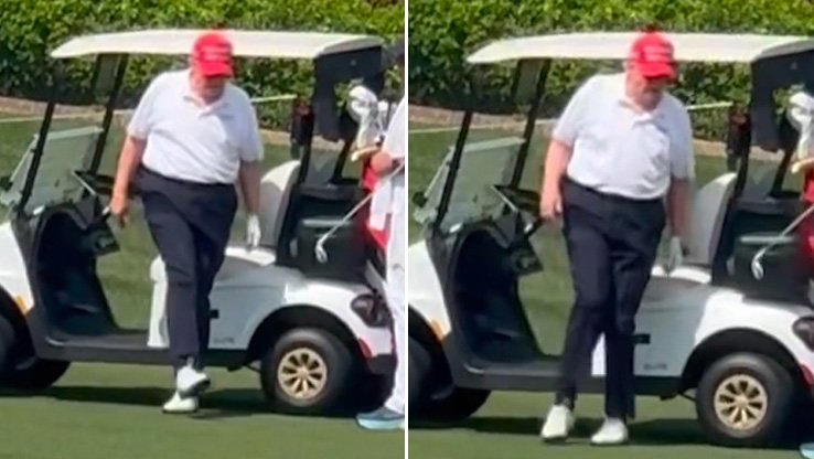 What's going on with Trump's legs?