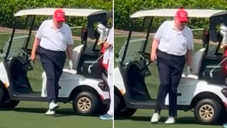 What's going on with Trump's legs?