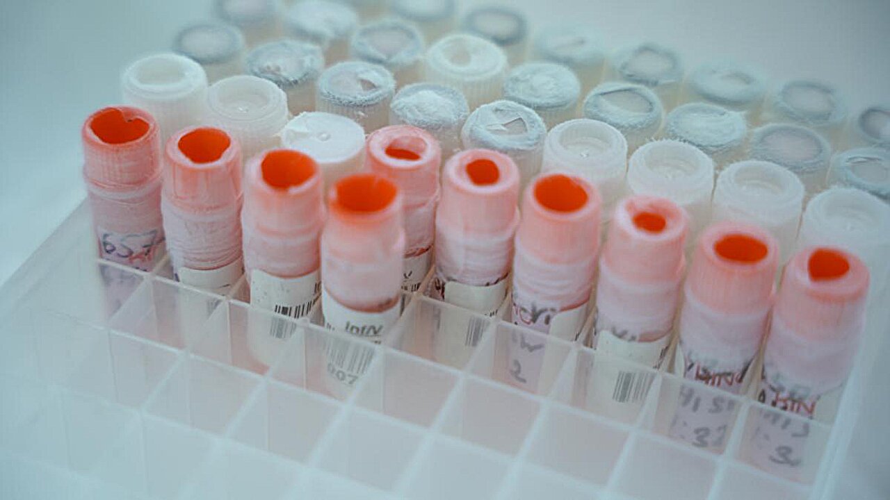 Scientists decide makeup of the 2025 flu vaccine