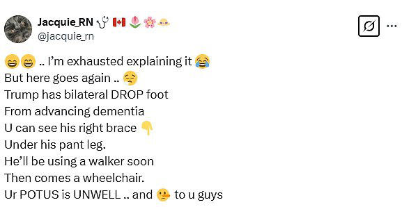 Experts reveal what they think is going on with Donald Trump's legs