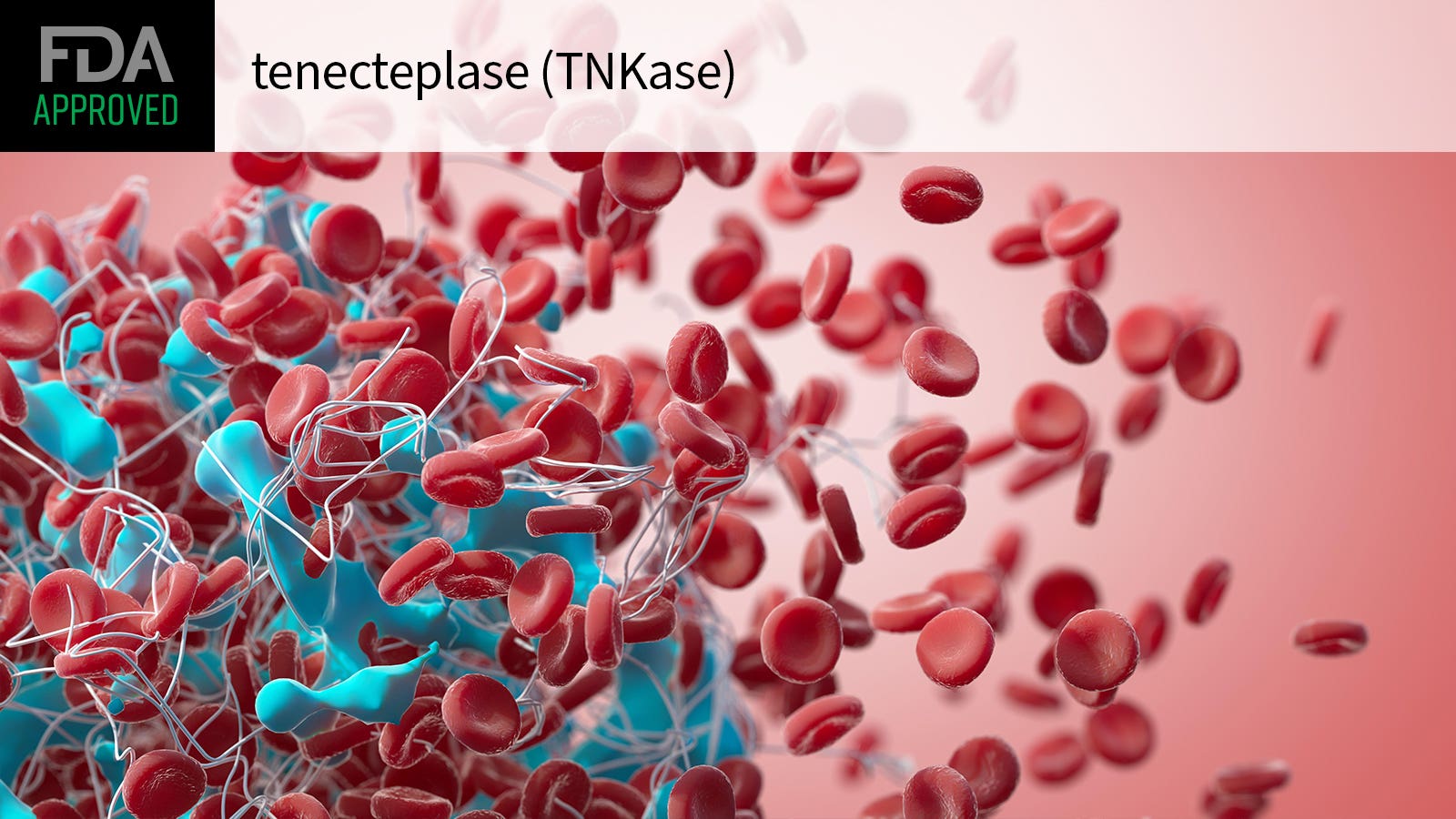 Tenecteplase No Longer Off-Label as Stroke Lytic
