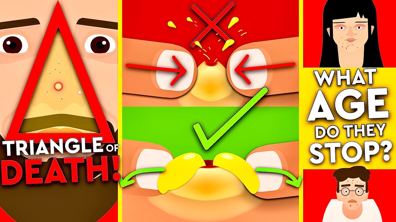 What Happens To Your Body When You Pop A Pimple?