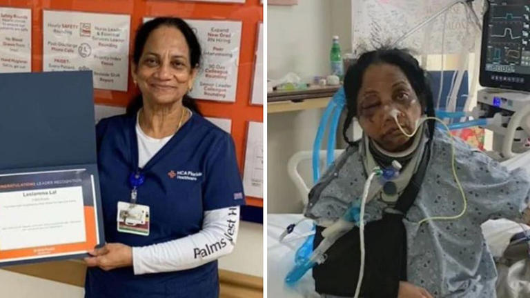 Indian-Origin Nurse Brutally Attacked, Face Left Disfigured By ... Indian-Origin Nurse Brutally Attacked, Face Left Disfigured By ...
