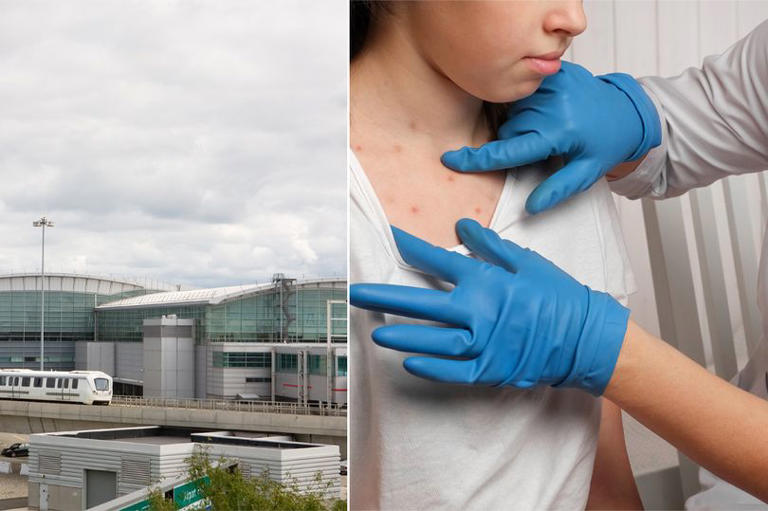 Measles outbreak spreads as Pennsylvania case sparks urgent JFK Airport ...