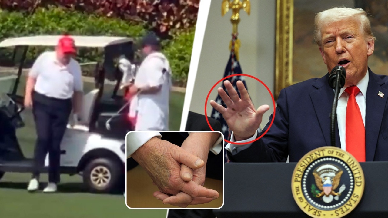 'What's wrong with Donald Trump's hands, legs?' Viral visuals spark ...