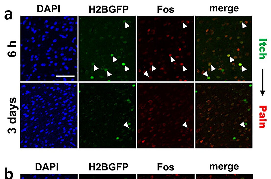 How the brain distinguishes between pain and itch