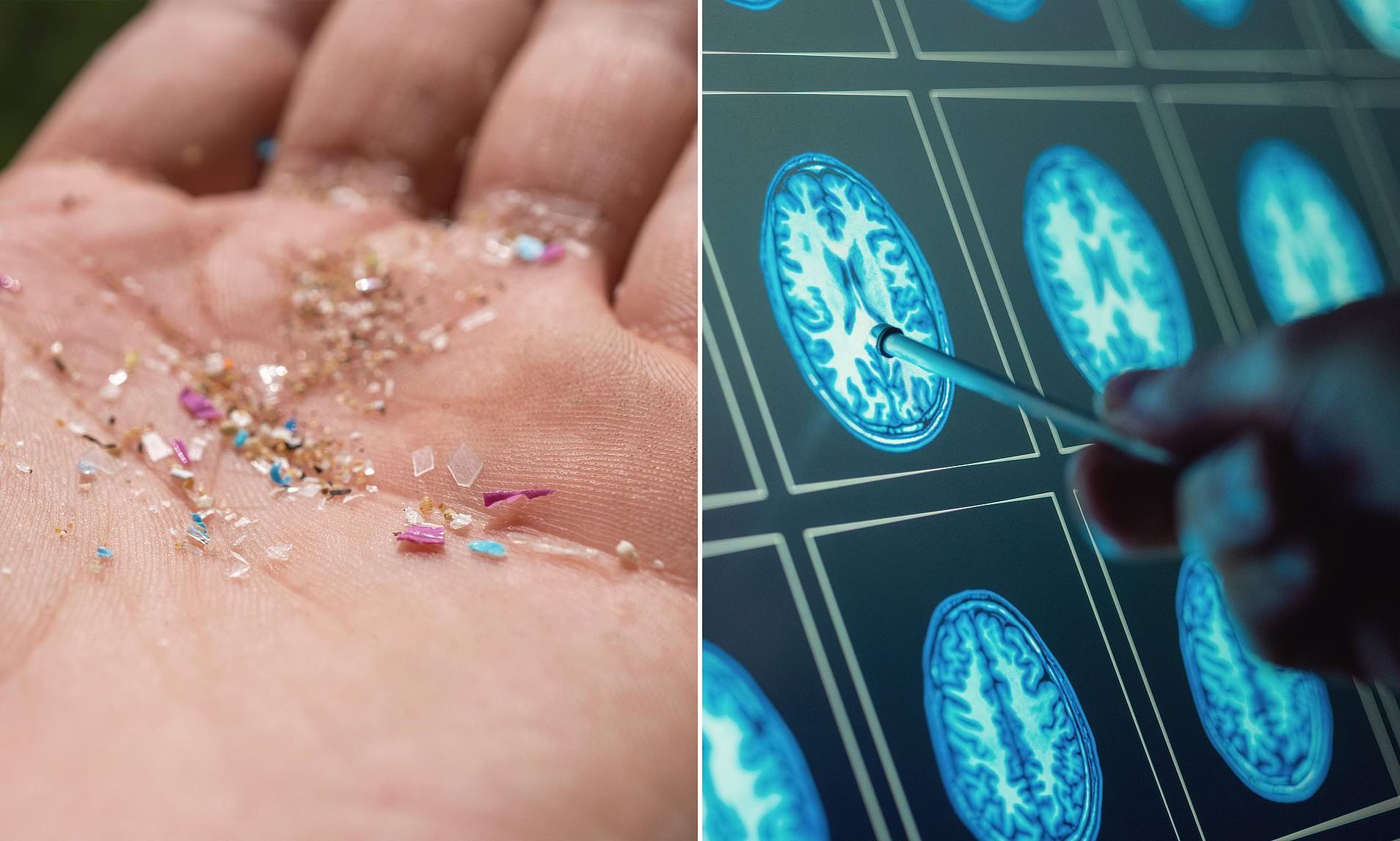 Toxic microplastics in the brain blamed on a product used by millions