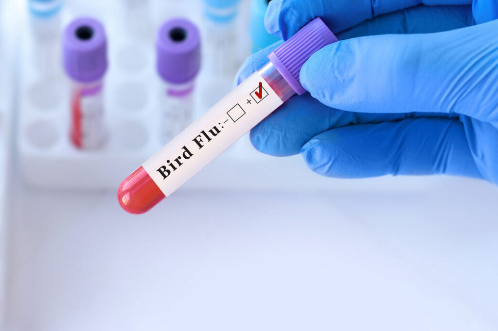 12 Bird Flu Myths vs. Facts According to Medical Experts 12 Bird Flu Myths vs. Facts According to Medical Experts