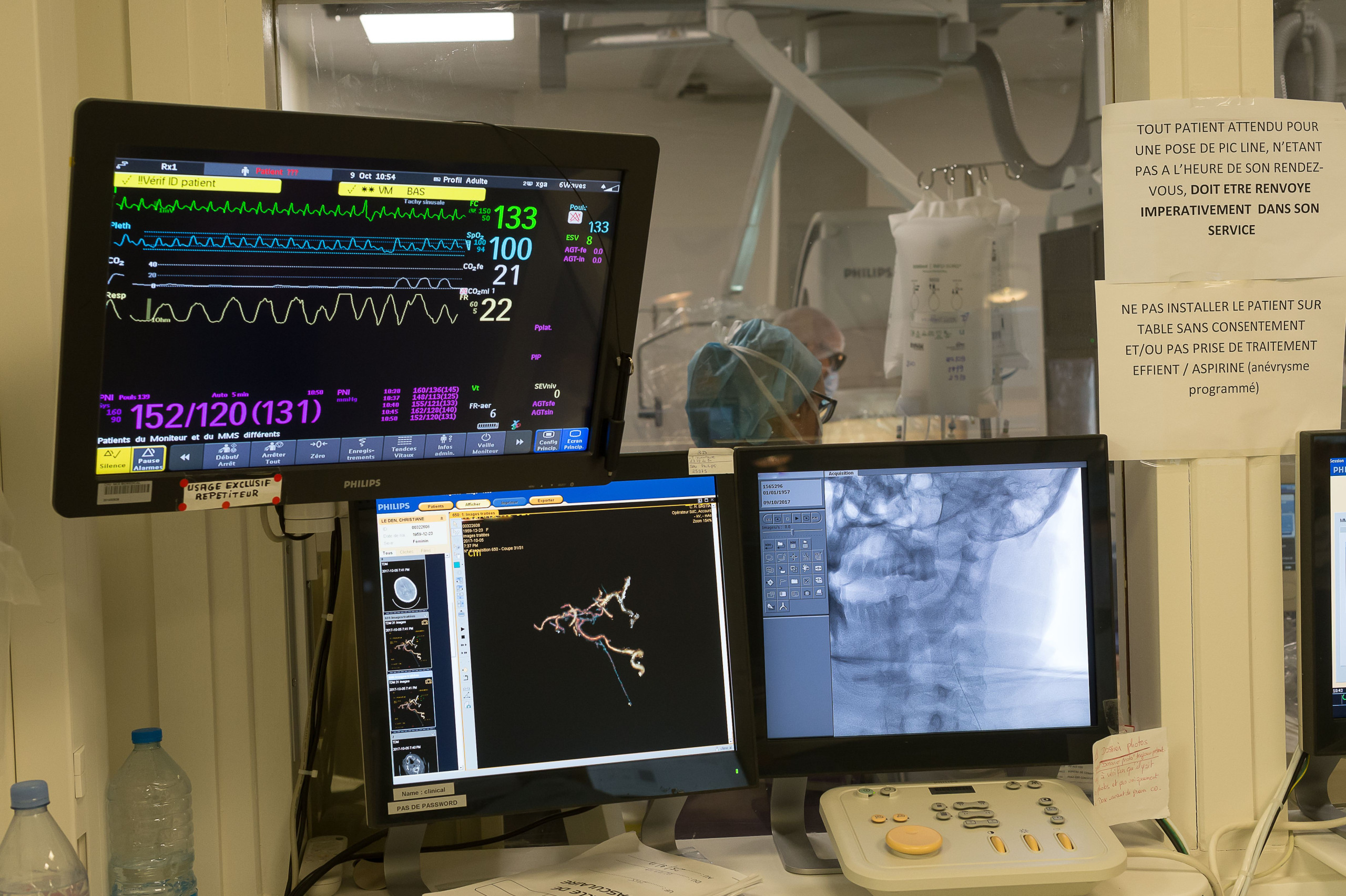 Uncommon medical conditions with really strange symptoms