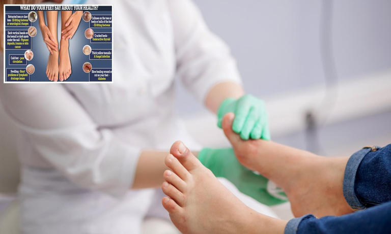 Why you need to check if you have an 'Irish pinky toe'