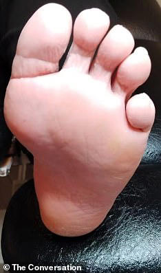 Why you need to check if you have an 'Irish pinky toe'