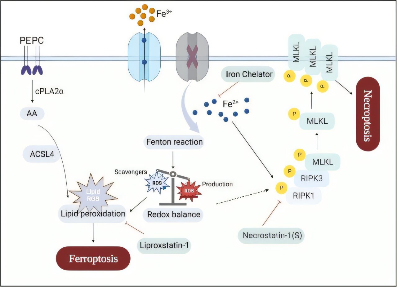 Iron overload: An accelerator of deadly cell responses in stroke