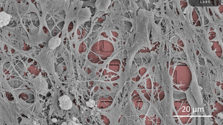 Melbourne startup launches 'biological computer' made of human brain cells